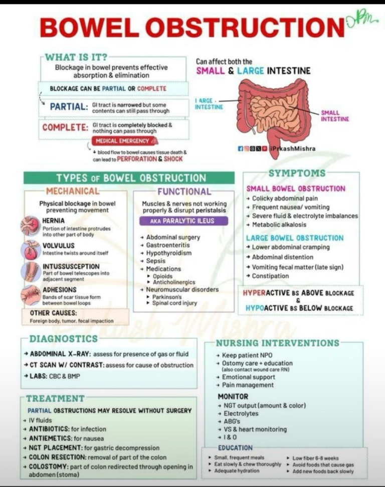Bowel Obstruction: Causes, Symptoms, Diagnosis, and Treatment - Pharma ...